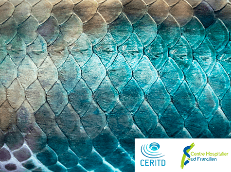 CERITD: Treating deep wounds with fish skin - Genopole